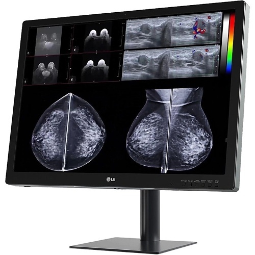 LG Pro 31HN713D-B 31" 12MP IPS Diagnostic Monitor for Mammography with ...